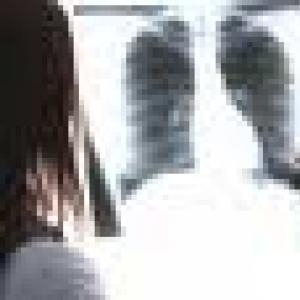 Insuficienta hepatica : Bolile ficatului